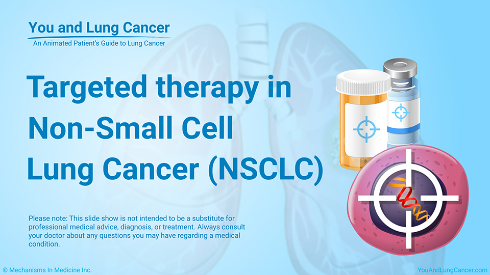 Lung Cancer Targeted Therapy